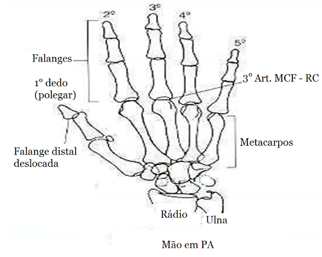 Laboratório de Roentgen: Membros Superiores Parte 1