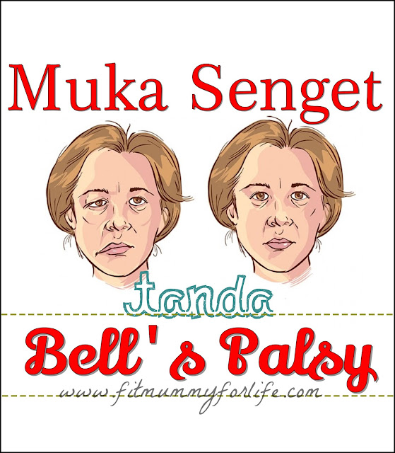 Muka Senget Tanda Bell's Palsy! | Fit Mummy For Life