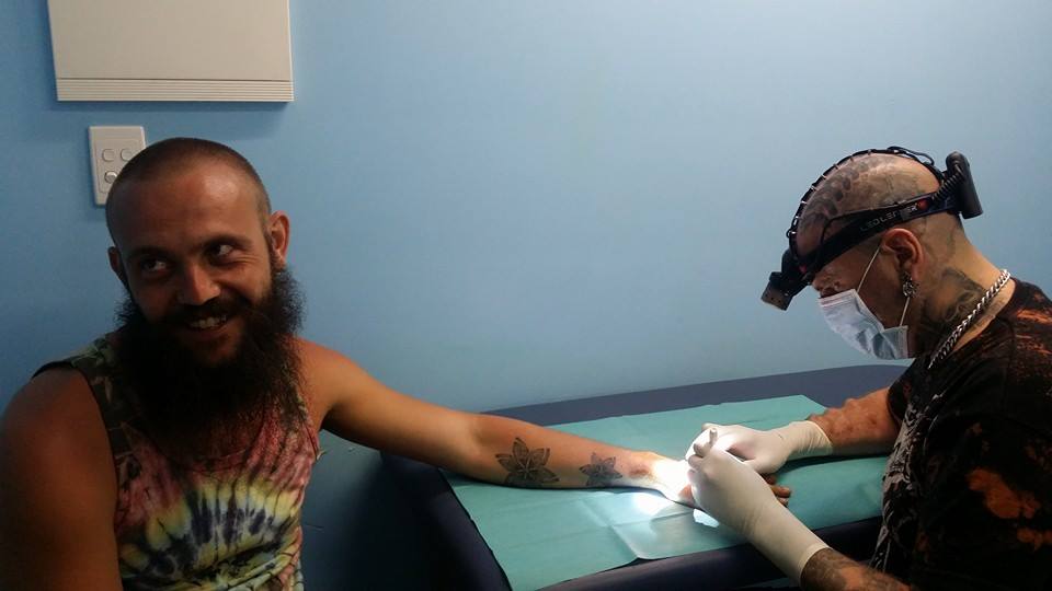 Human Modification: Subdermal Implants