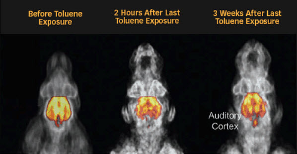 WTFrack.org: Studies of Toluene's Effects - vertigo, seizures, ataxia ...