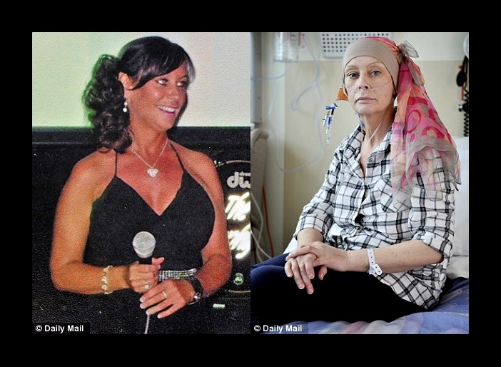 One-Moment-In-Time: My Breast Implants Have Given Me Cancer