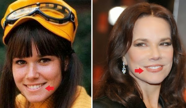 Did Barbara Hershey Plastic Surgery Disaster Before and After Photos