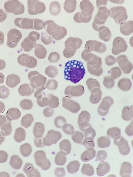 A Dull Day At Work...?: 20 September 2015 (Sunday) - Mott Cells