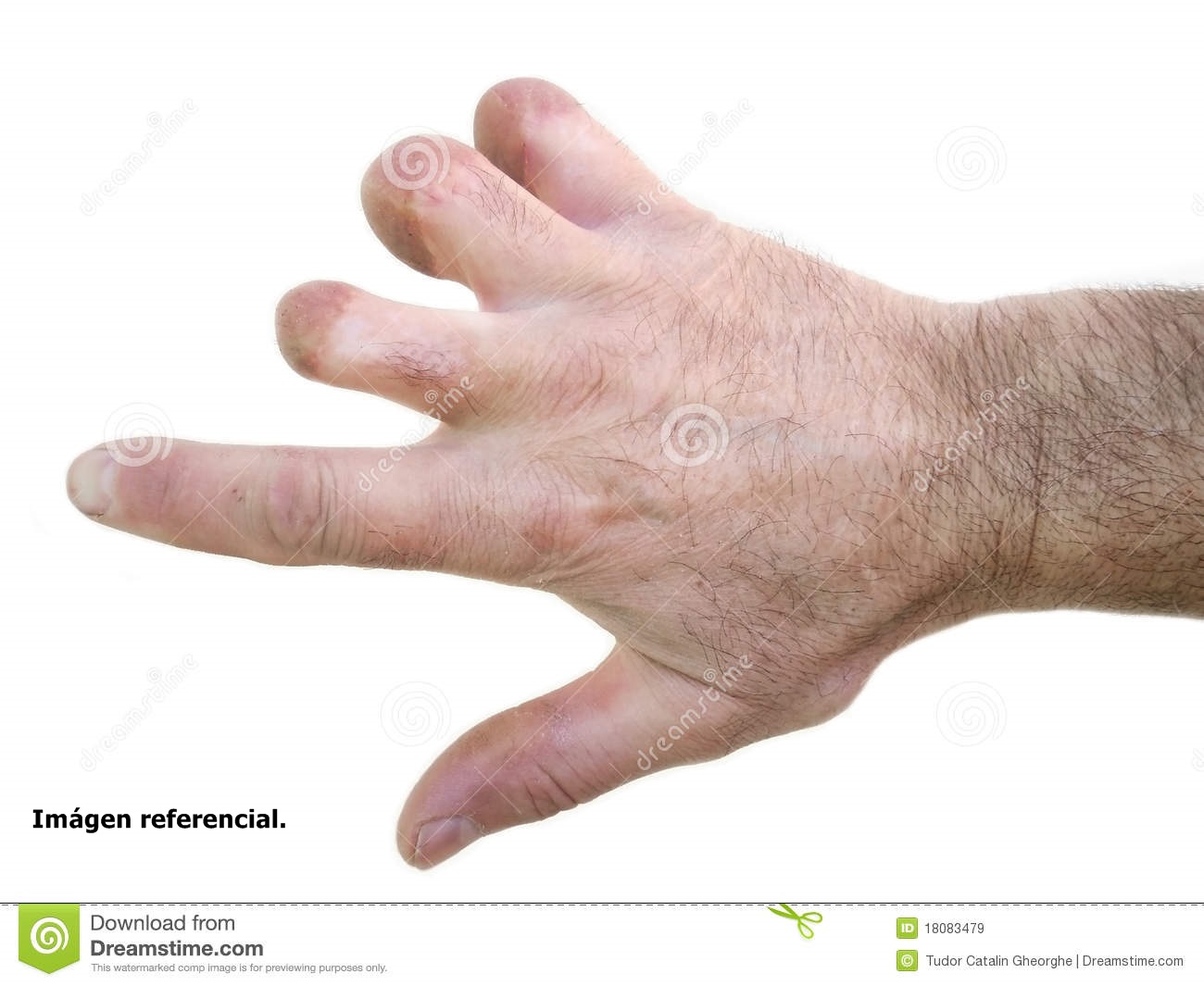 .: Ronderos de Moyobamba acuerdan mutilar dedos a delincuentes