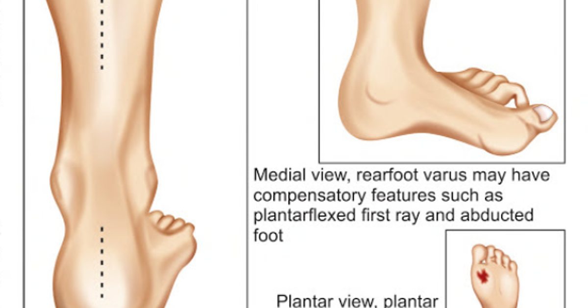 Hari's Random Thoughts by Hariharan Ramamurthy: Compensated ...