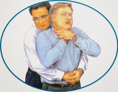 Smith’s Webclinic: First Aid Tips: Choking
