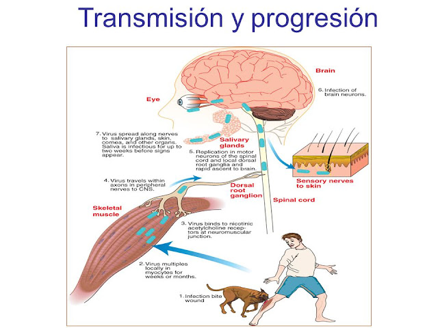 Universo Microbiológico: Rabia
