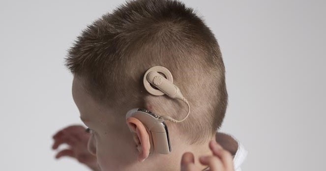 ART and ARCHITECTURE, mainly: Australia invented cochlear implants!