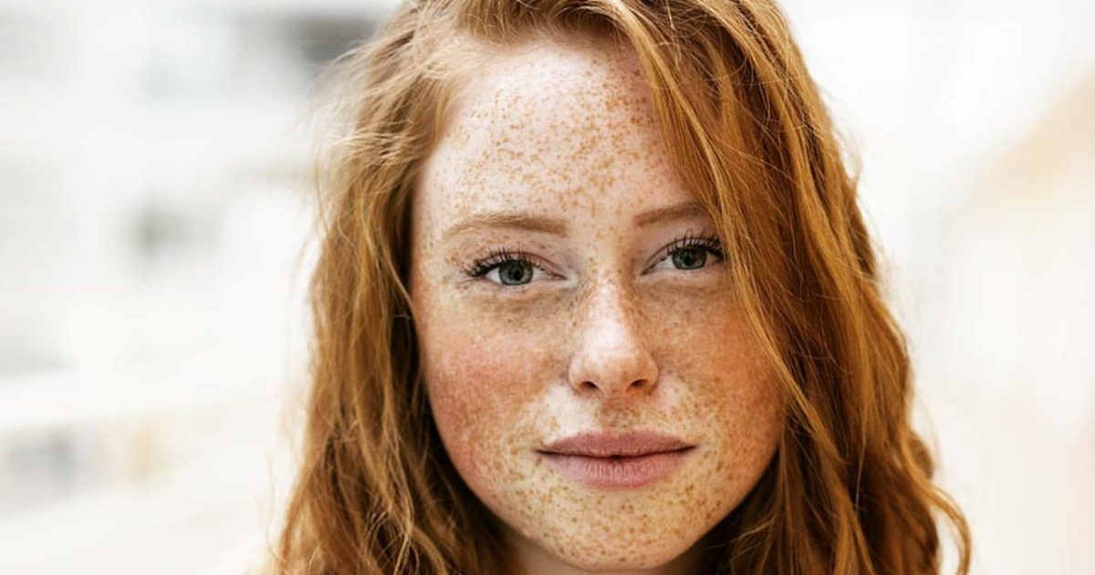 daily timewaster: Freckles, they are good