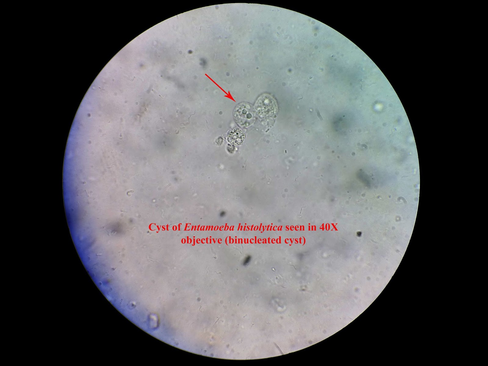 MICROBIOLOGY BLOG FOR STUDENTS (MBLOGSTU): Entamoeba histolytica