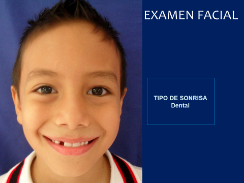 ANALISIS DE SONRISA: ANALISIS DE SONRISA, INTRODUCCION A LA ODONTOLOGIA