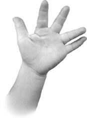 Nuestro esqueleto: Miembro superior: Malformaciones óseas de la mano