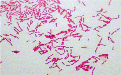 موقع الدكتور أحمد كلحى: صور باكتيريا - Bacteria slides : Aerobic, Gram ...