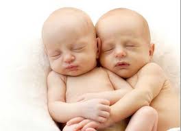 Dunia Pendidikan Kesehatan: KEHAMILAN GANDA (GEMELLI)