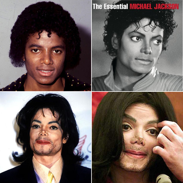 stars plastic surgery : Michael Jackson's Death Anniversary : 'The King ...