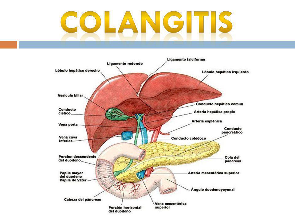 El día a día en el hospital: Complicaciones de la colangitis