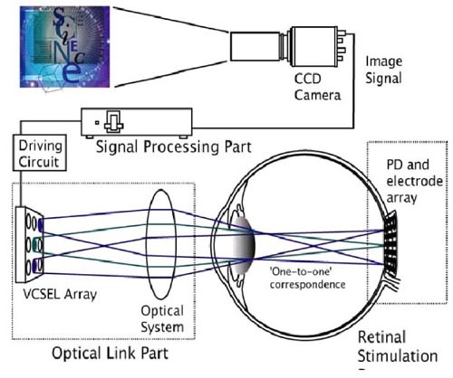 Depth of Processing: Bionic Eyes