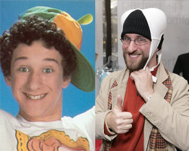 Dustin Diamond Plastic Surgery