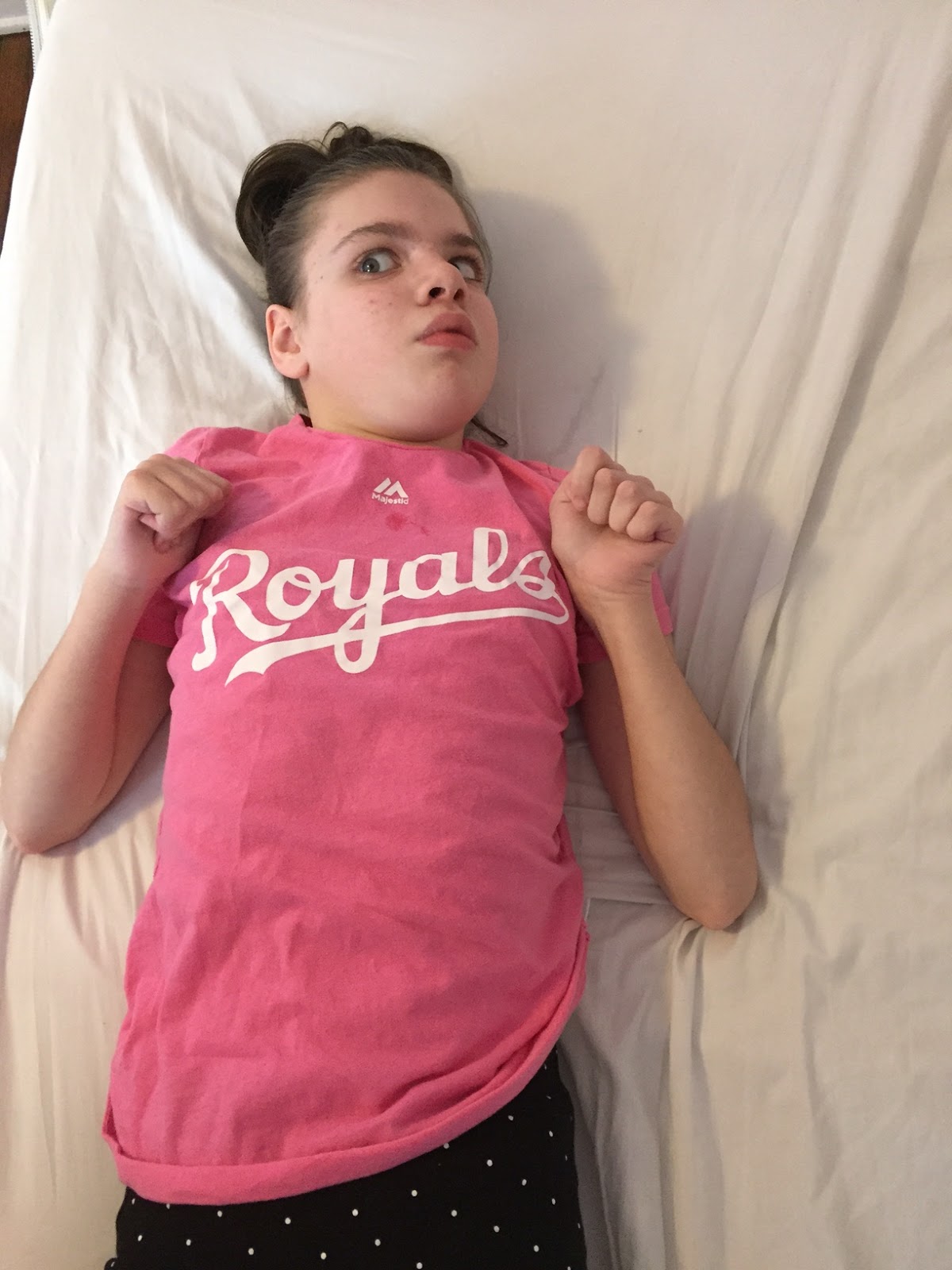 Miss Mira: Myoclonic Clusters