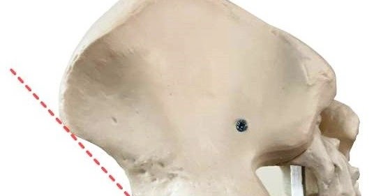 RealMadrid: KỸ NĂNG LÂM SÀNG NGOẠI: KHÁM CÁC MỐC GIẢI PHẪU VÀ ĐO CHIỀU ...