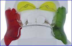 APARATOLOGIA ORTOPEDICA: FRANKEL III