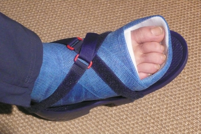 Cards and Quilts: loopgips