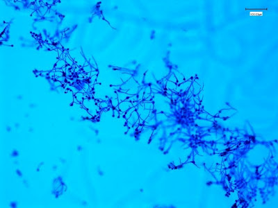 Fun With Microbiology (What's Buggin' You?): Absidia corymbifera ...