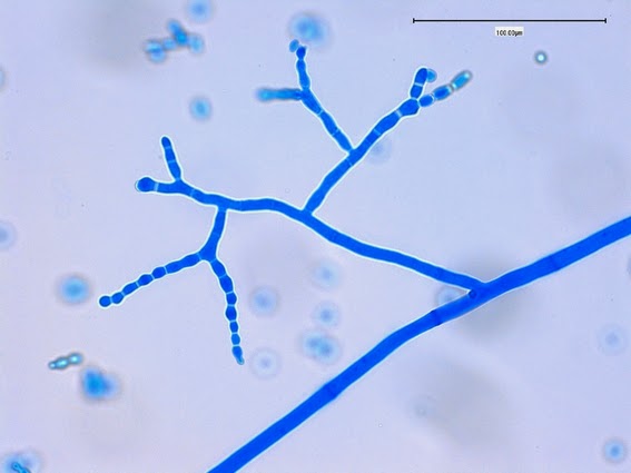 Fun With Microbiology (What's Buggin' You?): Chrysonilia sitophila