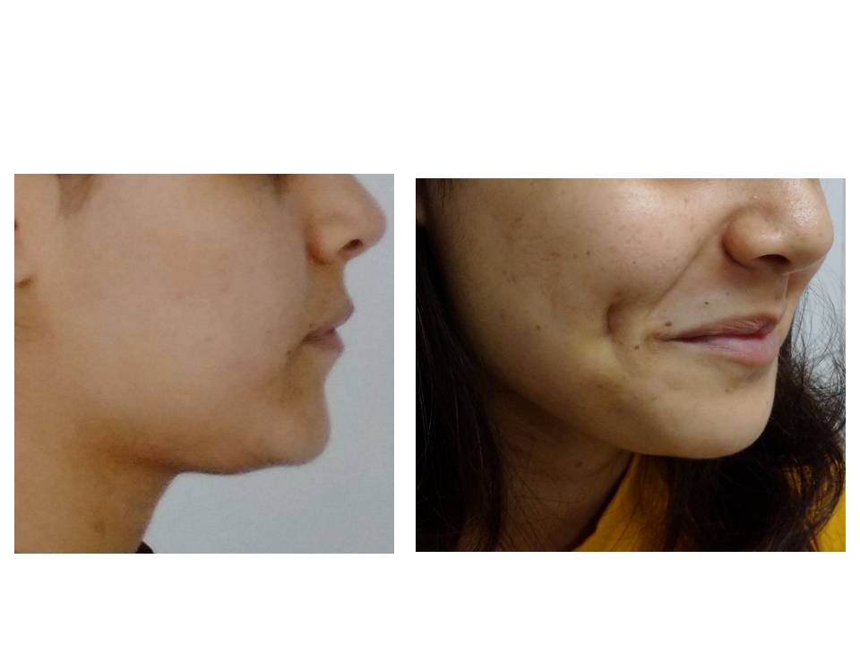 DR. ASHISH GUPTA: HIGHLIGHT YOUR SMILE WITH DIMPLES