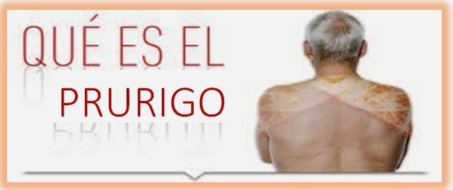 Dermatología 007: Prurigo (Grupo 1)
