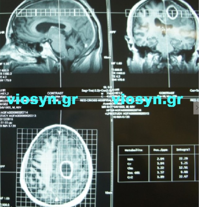 ΠΡΩΤΟΠΟΡΙΑΚΗ ΘΕΡΑΠΕΙΑ ΣΟΒΑΡΟΥ ΠΡΟΒΛΗΜΑΤΟΣ ΥΓΕΙΑΣ (ΠΑΡΟΥΣΙΑΣΗ ...