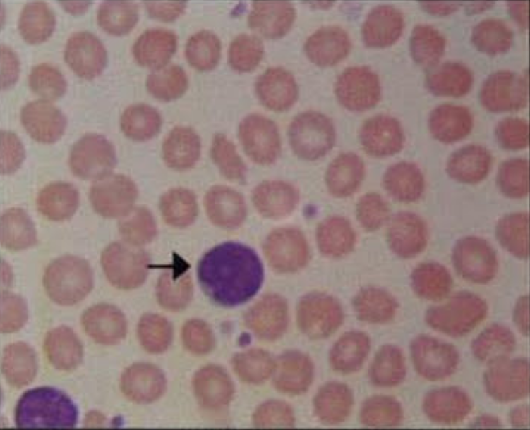 Fichero Hematológico: Línea Celular Leucocitaria