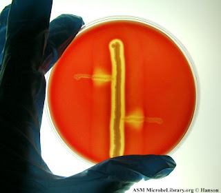 CAMP Test- Presumptive Identification of Group B Streptococcus (S ...