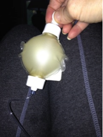 Jacki's Journey to Health: History of My Colon Cancer Journey: April ...