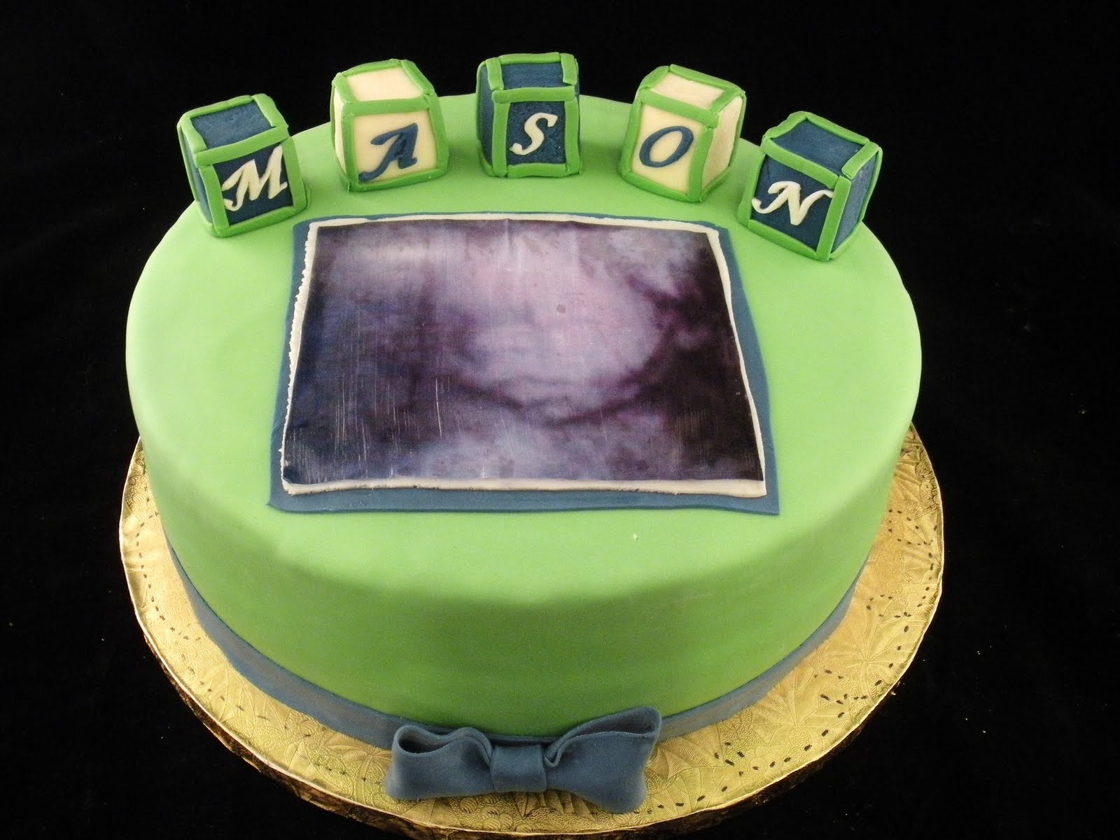Sugar & Spice Sweets: Ultrasound Cake