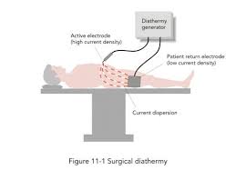 OTMANAGE: 06/01/2013 - 07/01/2013