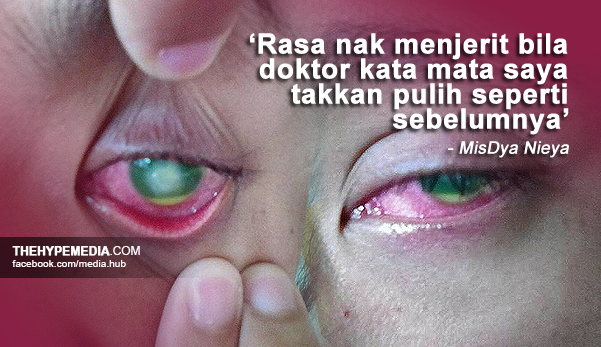 BAHAYA!!! CONTACT LENS BOLEH SEBABKAN PENYAKIT ULSER MATA? - KISAH BENAR