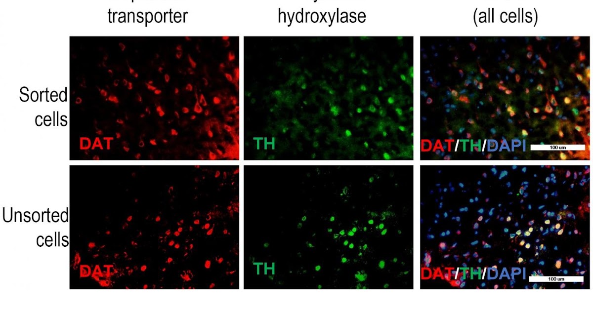 Our Parkinson's Place: Improving cell replacement therapy for Parkinson ...