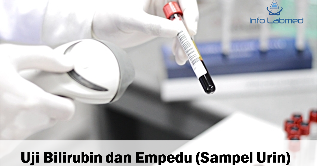 Uji Bilirubin dan Empedu (Sampel Urin) - Seri Pemeriksaan Laboratorium ...