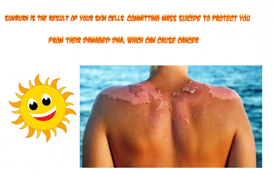 Signs Of Skin Cancer From Sunburn at Richard Harvey blog