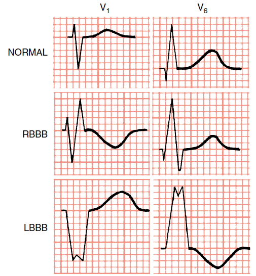 NOTA KEDOKTERAN: Interpretation of ECG (Introduction, Chambers ...