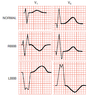 NOTA KEDOKTERAN: Interpretation of ECG (Introduction, Chambers ...