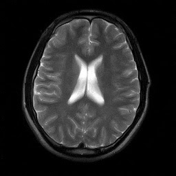 こくぶ脳外科・内科クリニック: 脳のMRI検査