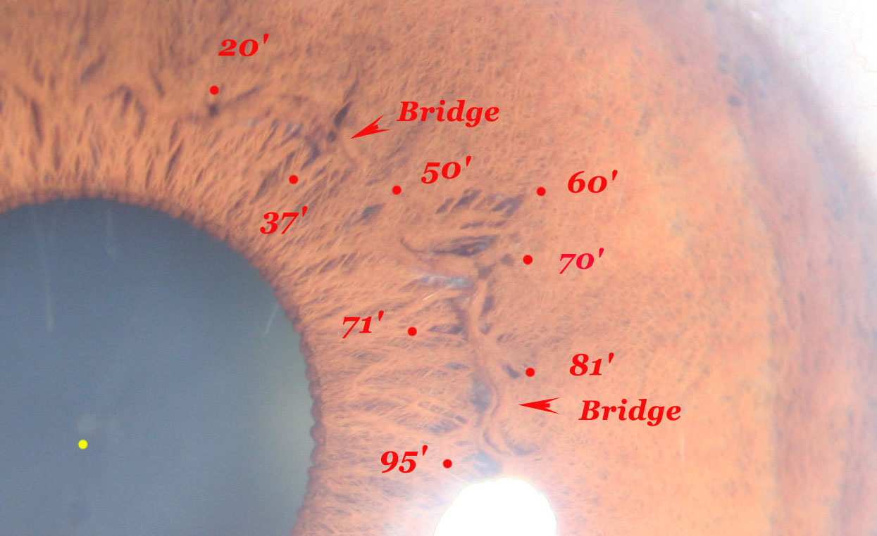 Modern & Multidimensional Iridology: The Internal & External Border of ...