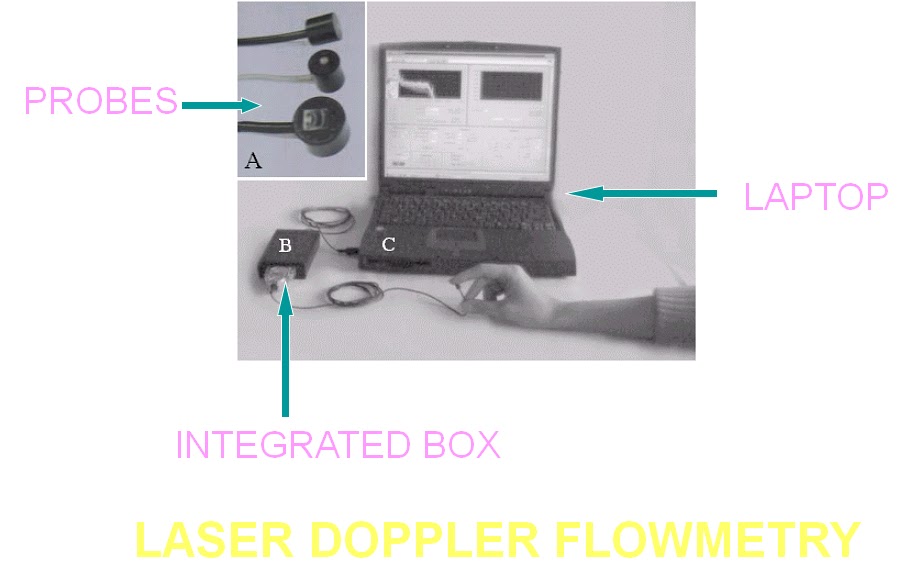 Endodontics: LASER DOPPLER FLOWMETRY