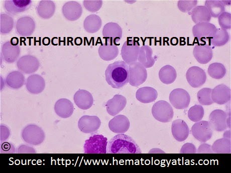 Lab Atlas: Orthochromatic Erythroblast