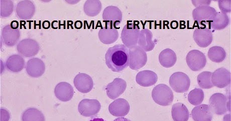 Lab Atlas: Orthochromatic Erythroblast
