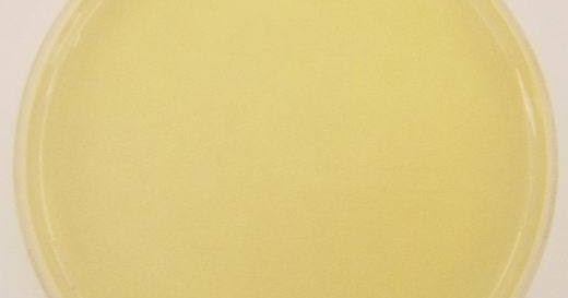 Media Nutrient Agar ~ Medical Laboratory Technologist