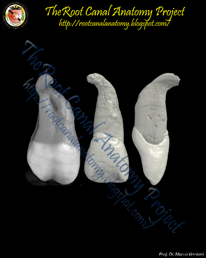 The Root Canal Anatomy Project: Root Curvature