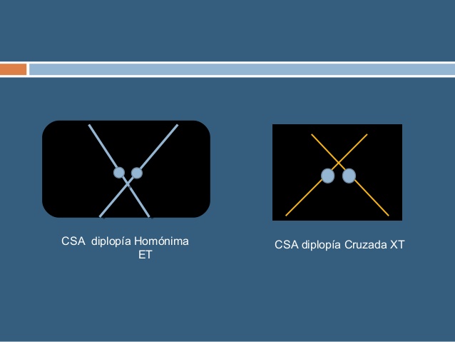 Test empleados en optometria : LENTES ESTRIADAS DE BAGOLINI